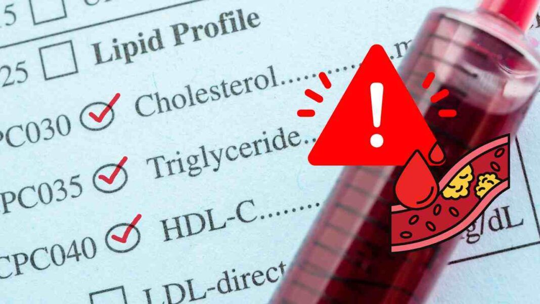 Colesterolo, glicemia alta e trigliceridi: cosa fare per abbassarli subito